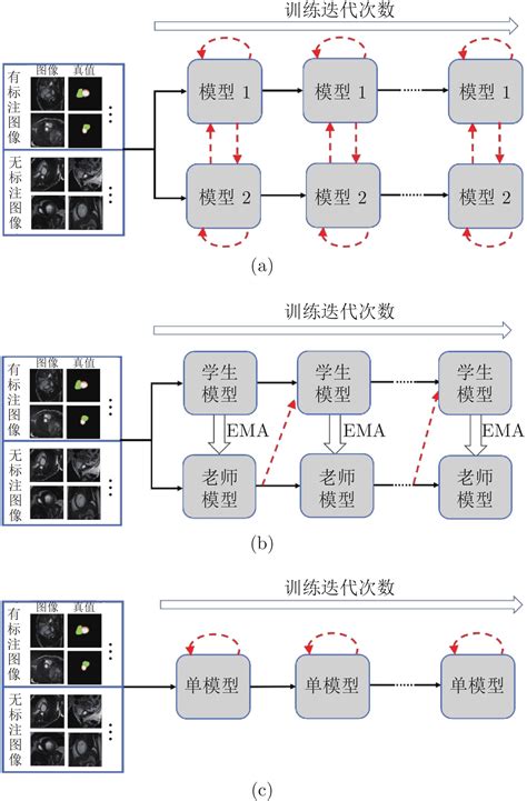 科学网基于双模型交互学习的半监督医学图像分割 欧彦的博文