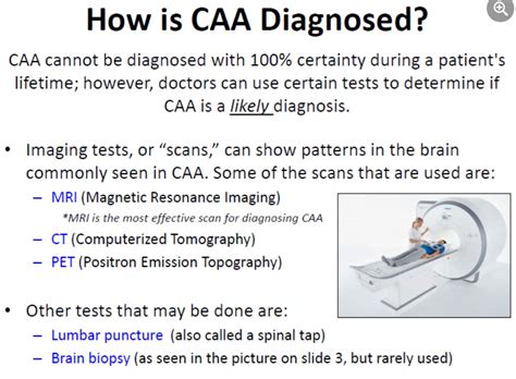 Andreas Charidimou Md Phd On Twitter Slides Continuing