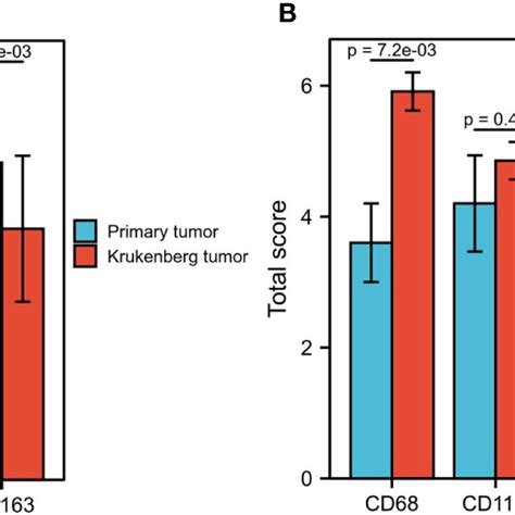 Grade Scoring Of Cd68 Tams In Tumor Stroma Of Primary Tumors A