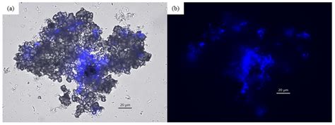 Novel Methanobacterium Strain Induces Severe Corrosion By Retrieving
