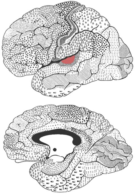 Aire De Brodmann 41 Cortex Auditifs Primaire Et Associatifs
