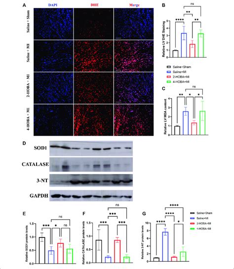 2 Hoba Attenuates Mi Induced Cardiac Oxidative Stress A G C57bl6