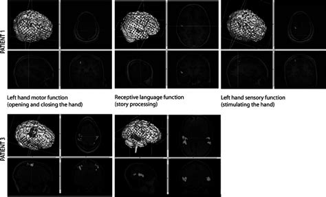 examples of original fmri data for motor sensory and language
