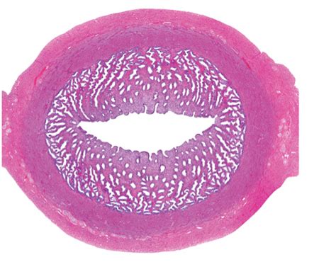 Uterine Wall Slide Diagram Quizlet