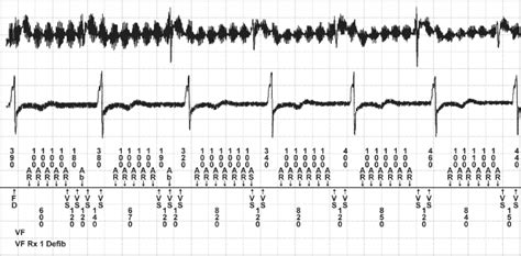 Electromagnetic Interference Sources Recognition And Management
