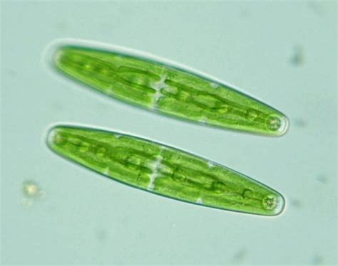 Protist Images Closterium Libellula Var Intermedium