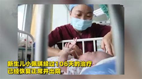 宝宝早产，只有巴掌大小，体重一斤二两，经过医生治疗后奇迹存活凤凰网