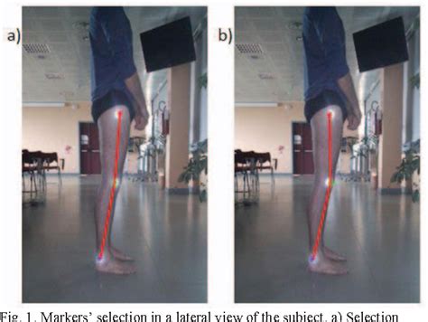 Figure 1 From Technical Challenges Using Magneto Inertial Sensors For Gait Analysis Semantic