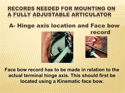 Types Of Articulators Pdf