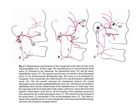 Stapedial Artery And Hyoid Artery