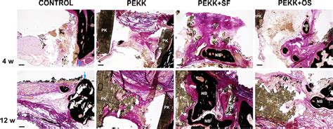 Representative Histological Sections Stained With Von Kossavan Gieson