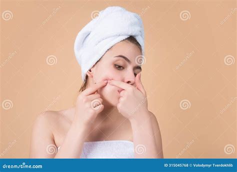 Close Up Woman Squeeze Out Pimples On Cheek Acne And Pimple On Skin