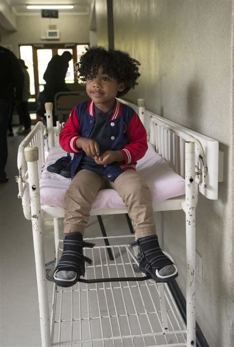 What Is Clubfoot Steps Clubfoot Support In Southern Africa