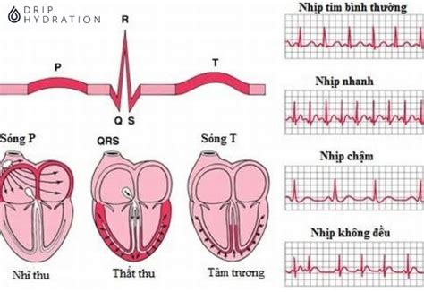 Phòng Ngừa Rối Loạn Nhịp Tim Biện Pháp Và Lời Khuyên Chuyên Sâu