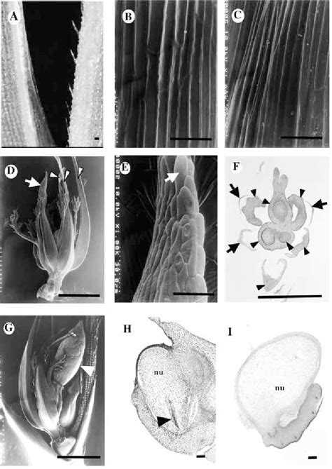 Figure 1 From Superwoman1 And Drooping Leaf Genes Control Floral Organ