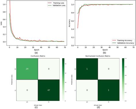 Brain Tumor Classification Using Fine Tuned Transfer Learning Models On Magnetic Resonance