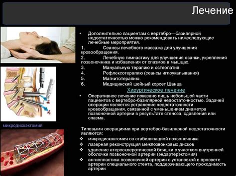 Синдром вертебробазилярной недостаточности синдром вертебробазилярной