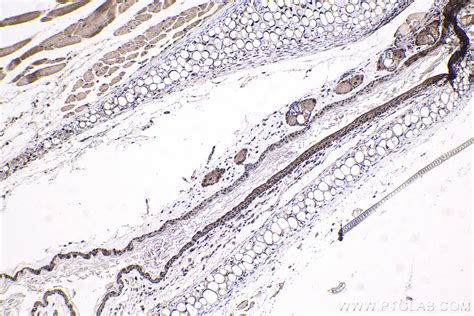 Exosc10 Antibody 16731 1 Ap Proteintech