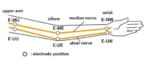 Positions Of The Cathodal Electrode In Each Condition Download