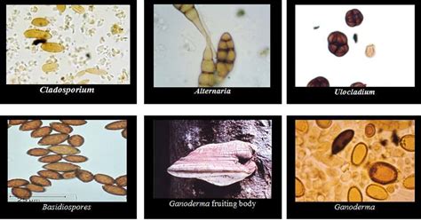 Pictures Showing Different Types Of Fungal Spores Download Scientific