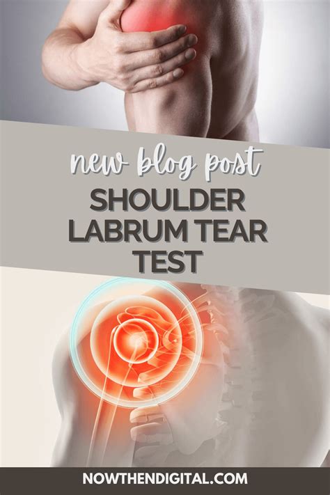 Shoulder Labrum Tear Test How To Diagnose And Treat This Common Injury