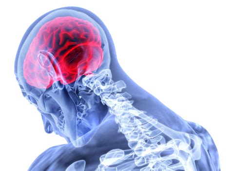 Comprendre le Diagnostic de la Sclérose en Plaques Une Introduction