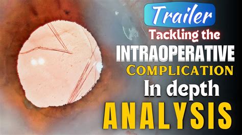 Trailer Tackling The Intraoperative Complication In Depth Analysis