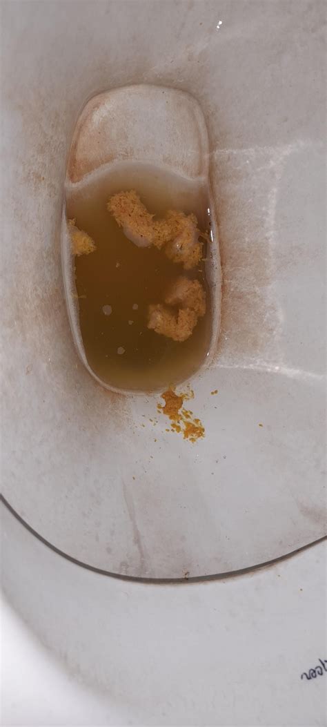 Toilet Poop Rpoop