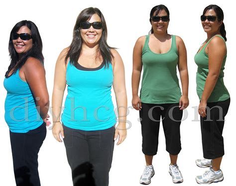 Hcg Diet Before And After Pictures Kaala Do It Yourself Hcg