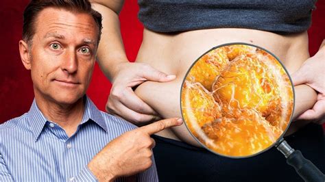 Как избавиться от жира на животе Самый опасный вид жира 👀 Youtube