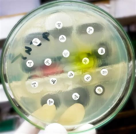 Premium Photo Antimicrobial Susceptibility Testing In Petri Dish