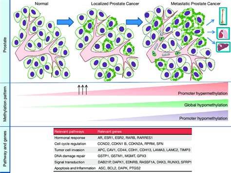 Epigenetic Alterations During Prostate Cancer Initiation And