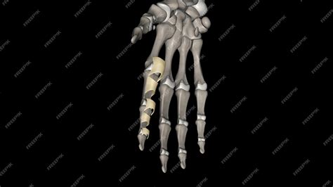 Premium Photo The Annular Ligament Is A Complex Structure Formed From The Capsule Lateral