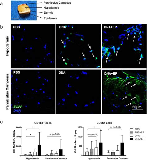 Antigen Expression And Immune Cell Characterization In The Subcutaneous Download Scientific