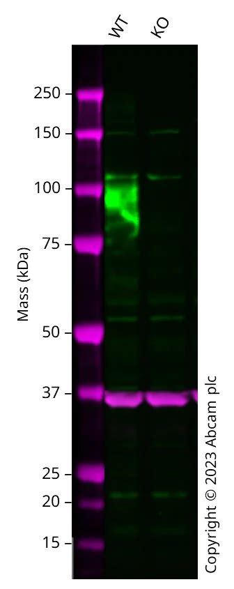 Anti Cd68 Antibody [rm1031] Macrophage Marker Ab303565 Abcam