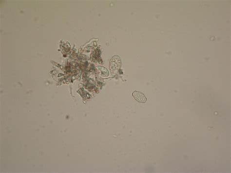 Phytophthora Cactorum Phytophthora Root Rot
