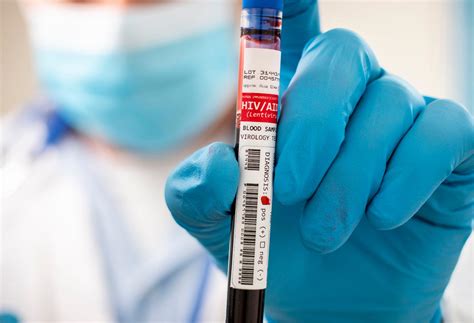 Mayapada Hospital Kenali Hivaids Dan Penyebarannya