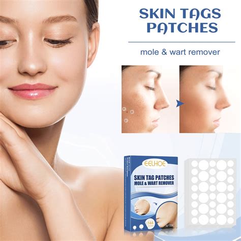 144pcs Skin Tags Removal Patches Safe Painless Acne Wart Removal