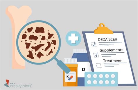 Osteoporosis Therapy Overview
