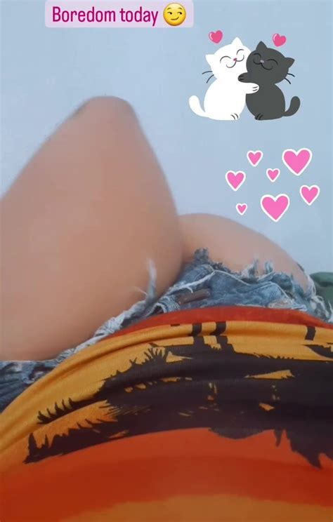 Quad Woman Leg Stump