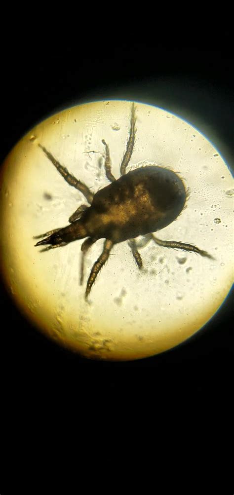 Mite Id Rwhatsthisbug