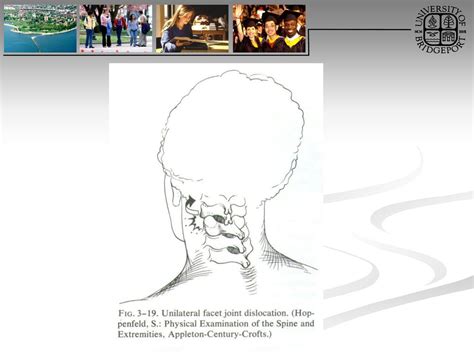 James J Lehman Dc Mba Dabco Dx 612 Orthopedics And Neurology Ppt
