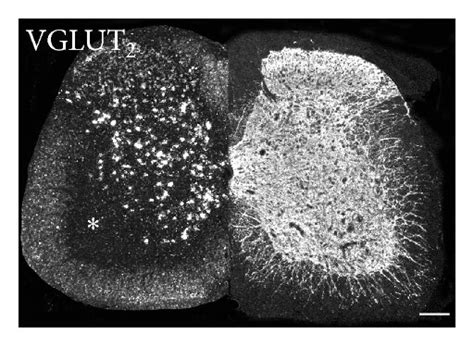 Vgluts Protein And Transcript Expressions In The Mouse Spinal Cord