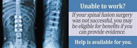 Can You Get Disability For A Spinal Fusion
