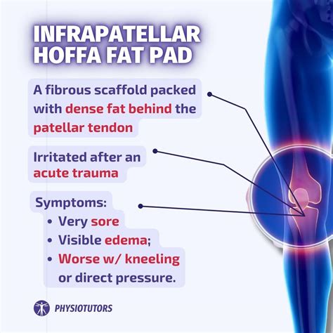 Physiotutors Infrapatellar Fat Pad 🦵the Infrapatellar