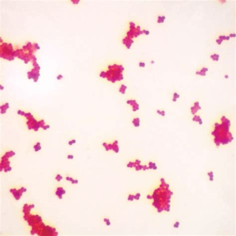 Gram Positive Vs Gram Negative Microscope