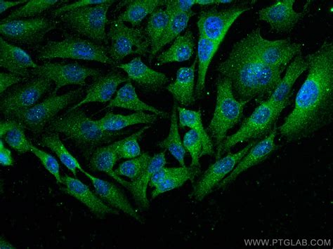 Cathepsin B Antibody 12216 1 Ap Proteintech