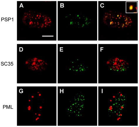 Fluorescent Puncta In The Nucleus Of A Hela Cell Images Were Acquired