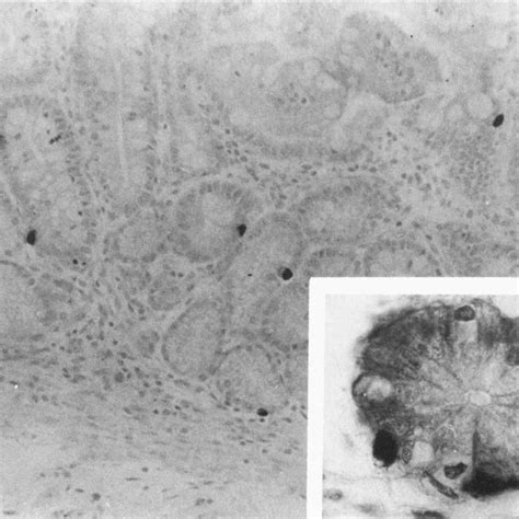 Pdf Apud Cells In Teratomas