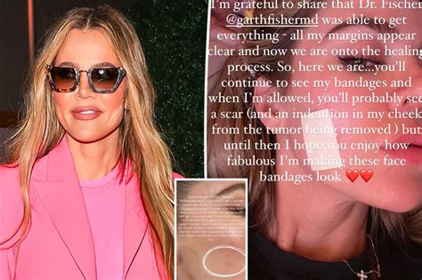 Khloé Kardashian Explains Face Bandage Reveals She Had Tumor Removed